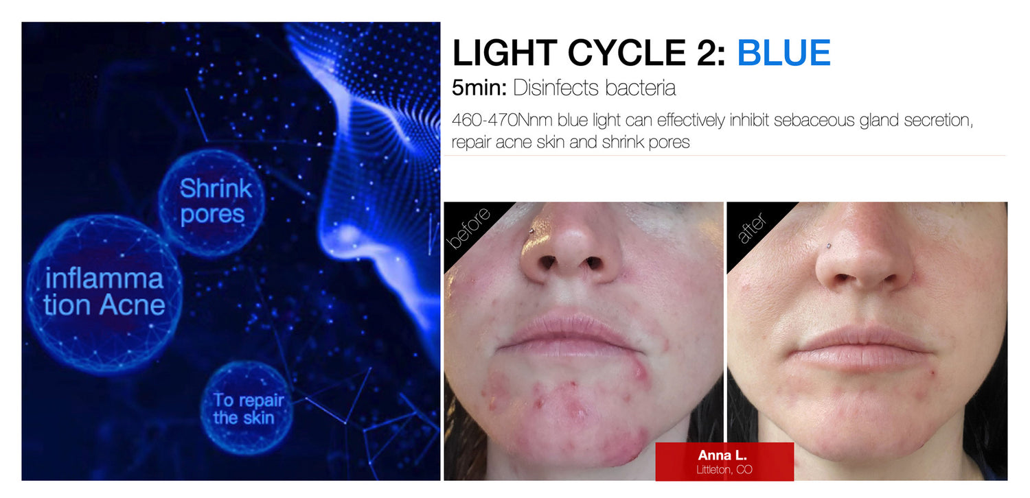 Halo LED Facial Glowing Mask